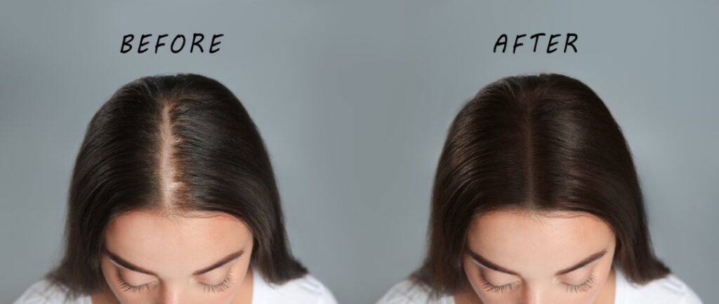 J'ai des cheveux clairsemés : comment redensifier ma chevelure ...